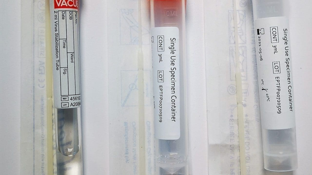 Vorübergehende Einführung weiterer Abstrichmaterialien | Labor Koblenz